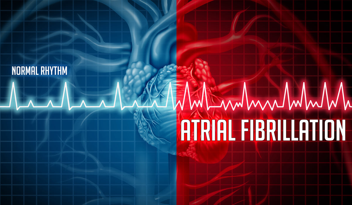 Can Smartwatches Detect AFib? | PulseNexa